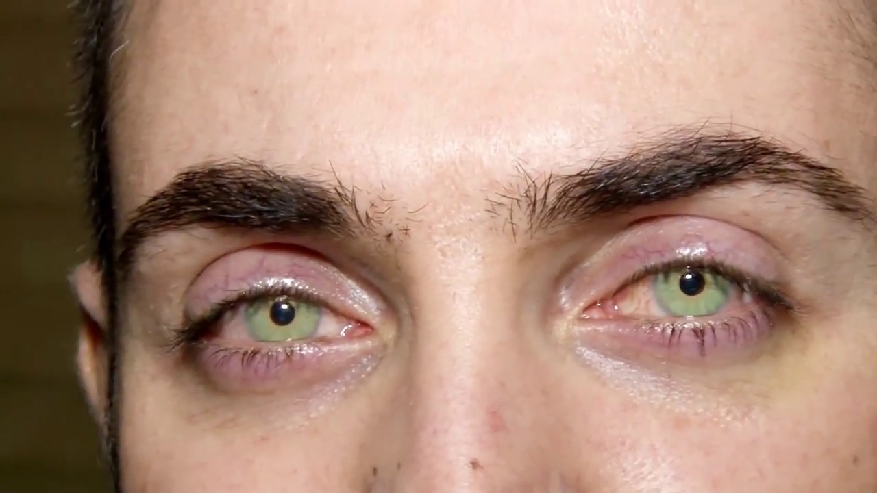 Comment on appelle les yeux qui change de couleur