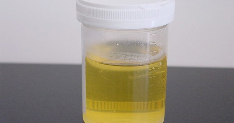 Pourquoi une urine mousseuse