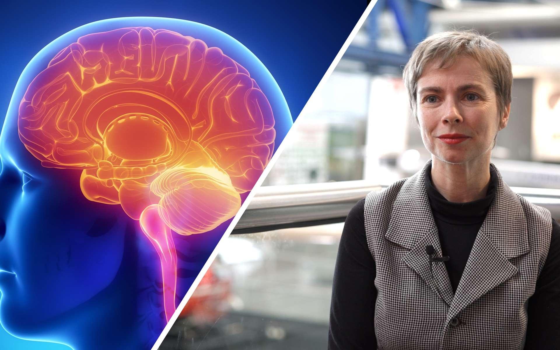 Qu'est-ce qu'une décompensation psychique